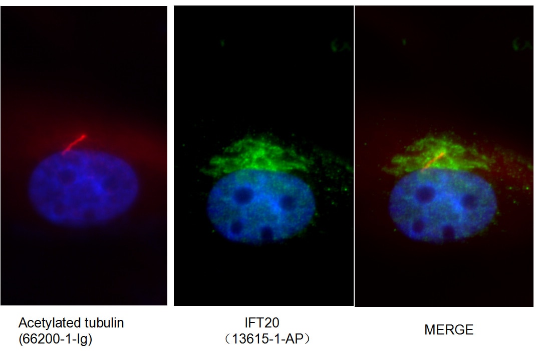 IFT20 antibody (13615-1-AP) | Proteintech