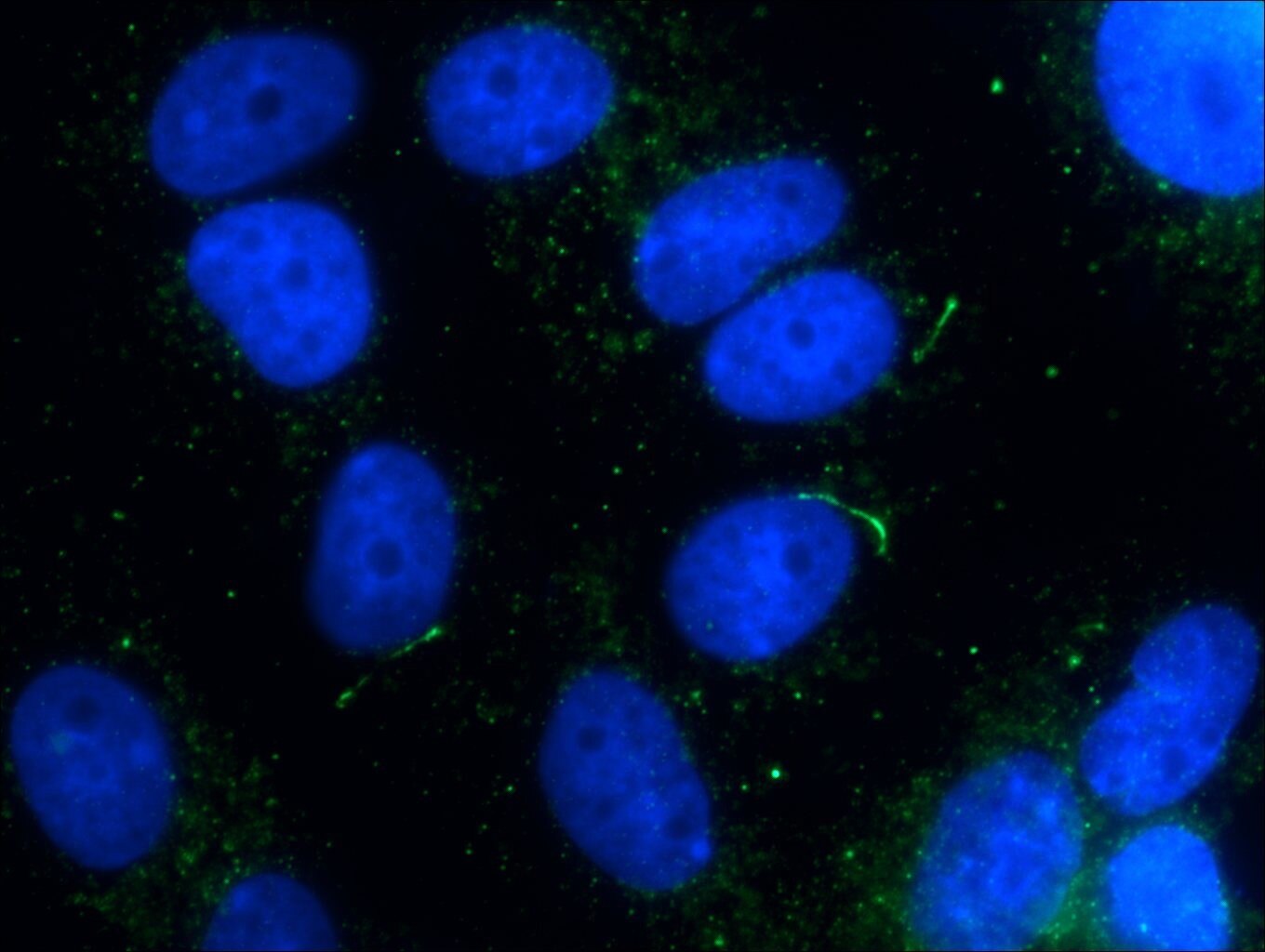 ARL13B antibody (17711-1-AP) | Proteintech