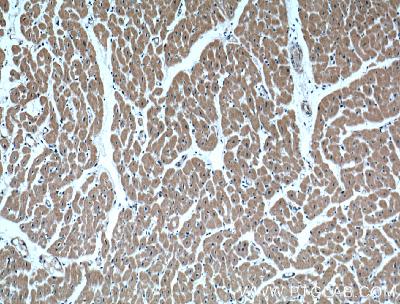 IGBP1 antibody (60256-1-Ig) | Proteintech