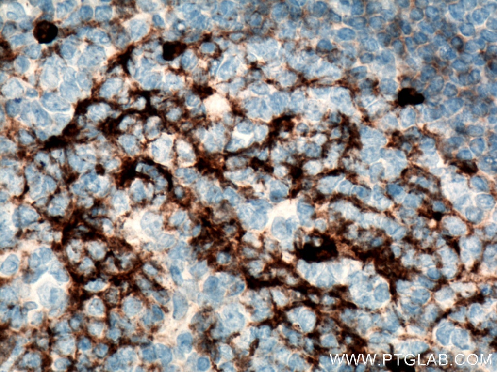 human IgM antibody (66484-1-Ig) | Proteintech