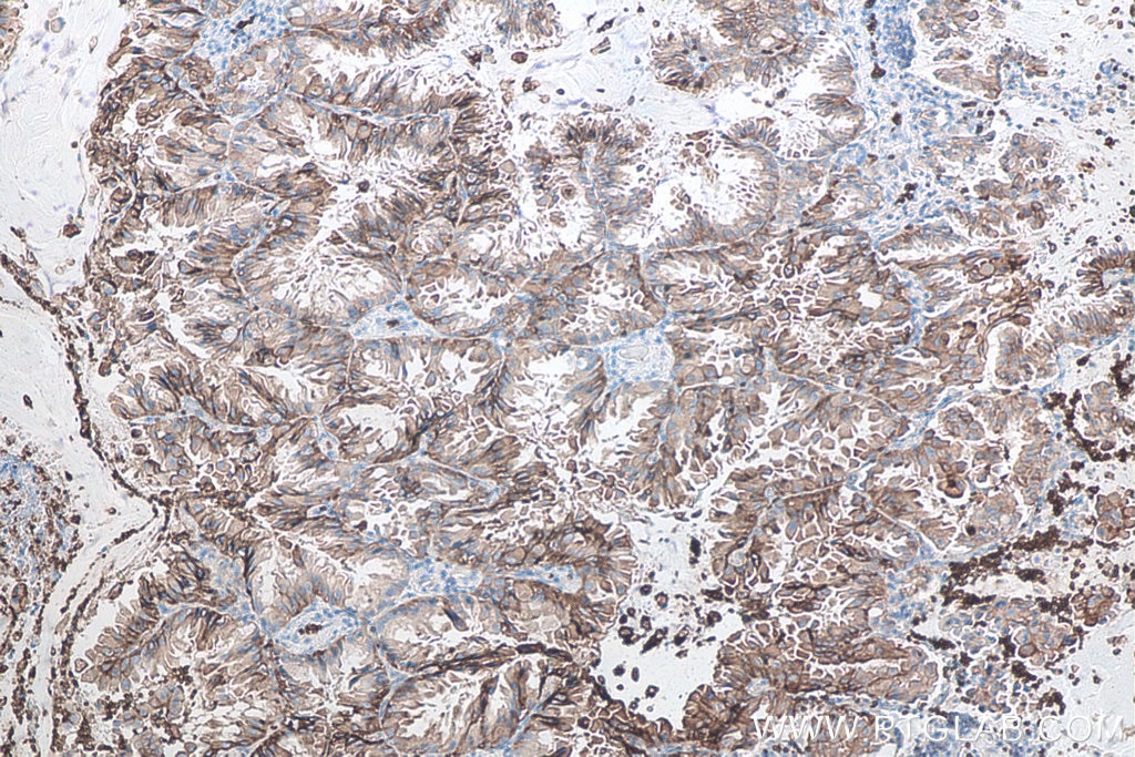 IHCeasy GLUT1 Ready-To-Use IHC Kit KHC0036 | Proteintech