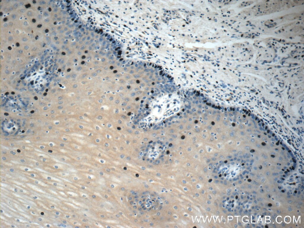 IL-36 Gamma antibody (60248-1-Ig) | Proteintech