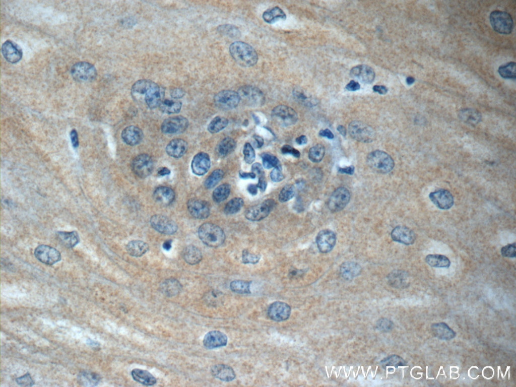 IL-36 Gamma antibody (60248-1-Ig) | Proteintech
