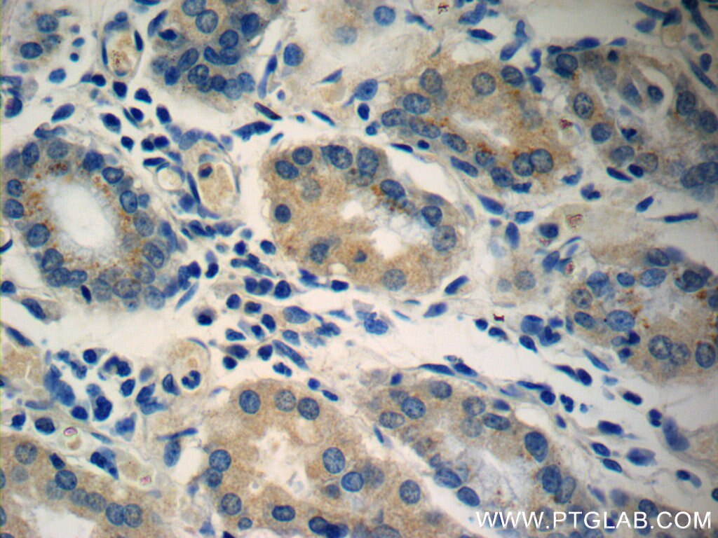 IL-36 Gamma antibody (60248-1-Ig) | Proteintech