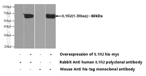 IL-1R2 antibody (60262-1-Ig) | Proteintech