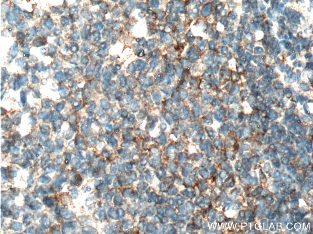 IL-3 antibody (17835-1-AP) | Proteintech