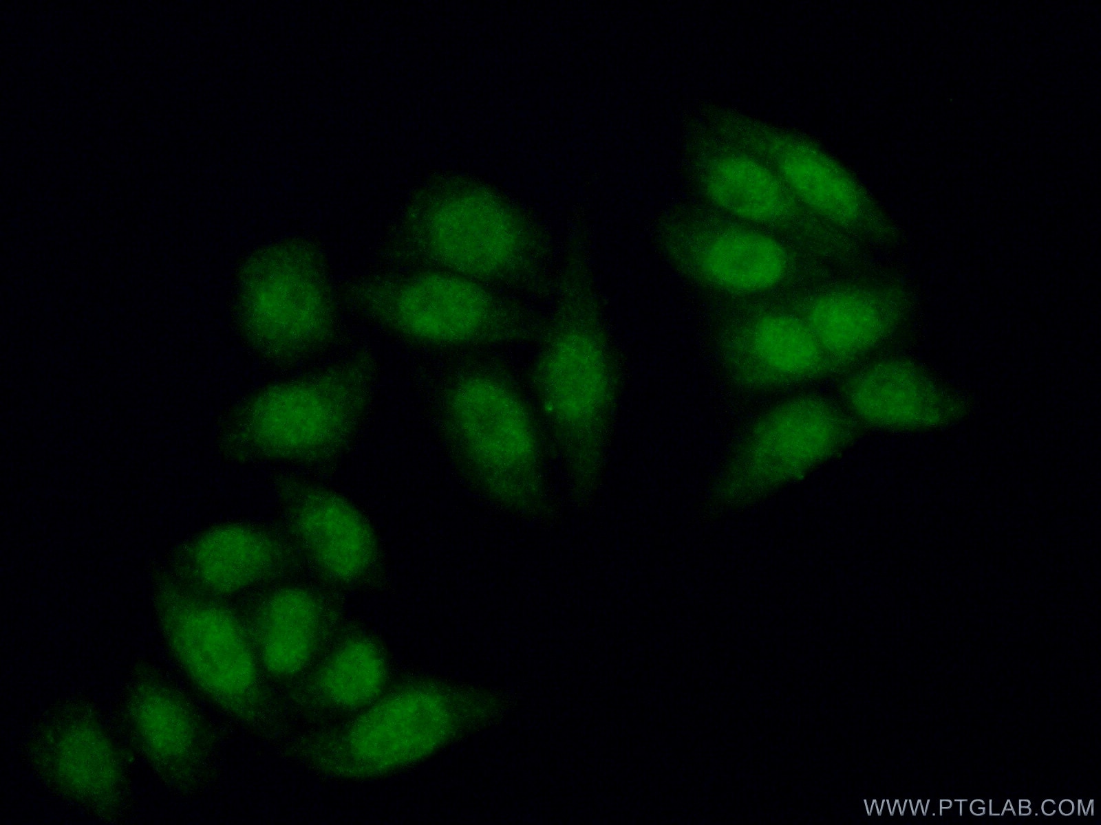 IMP3 antibody (12750-1-AP) | Proteintech