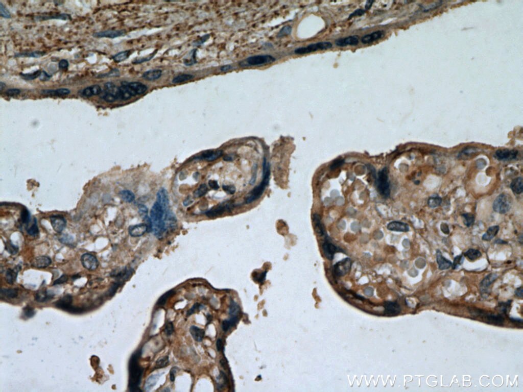 Inhibin beta A Antibody 10651-1-AP | Proteintech