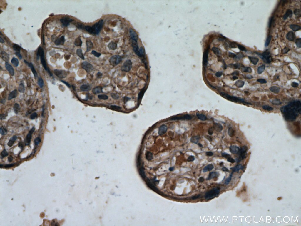 Inhibin beta A Antibody 10651-1-AP | Proteintech