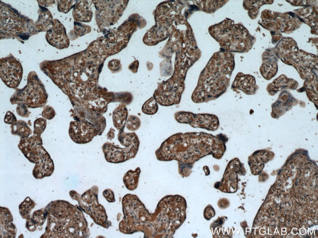 Inhibin beta A Antibody 10651-1-AP | Proteintech