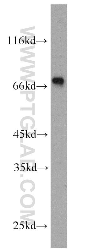 FAF2 antibody (16251-1-AP) | Proteintech