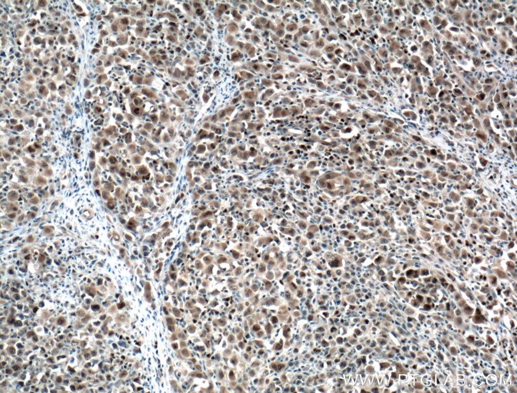 MUM1/IRF4 antibody (11247-2-AP) | Proteintech