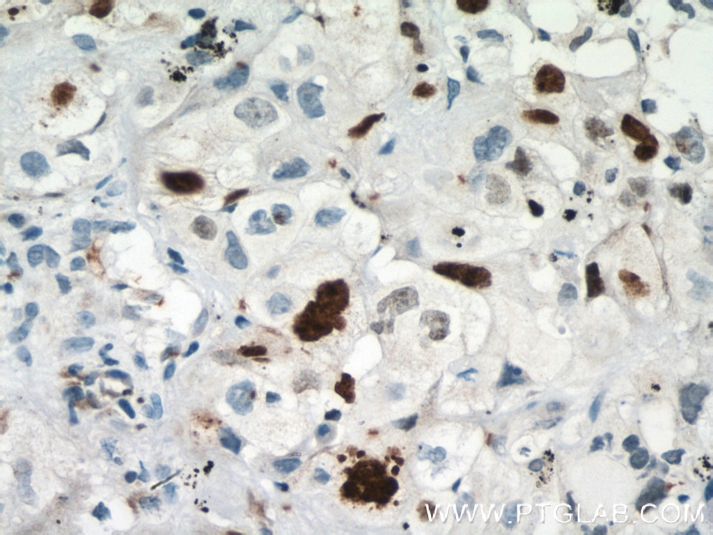 KI67 antibody (27309-1-AP) | Proteintech