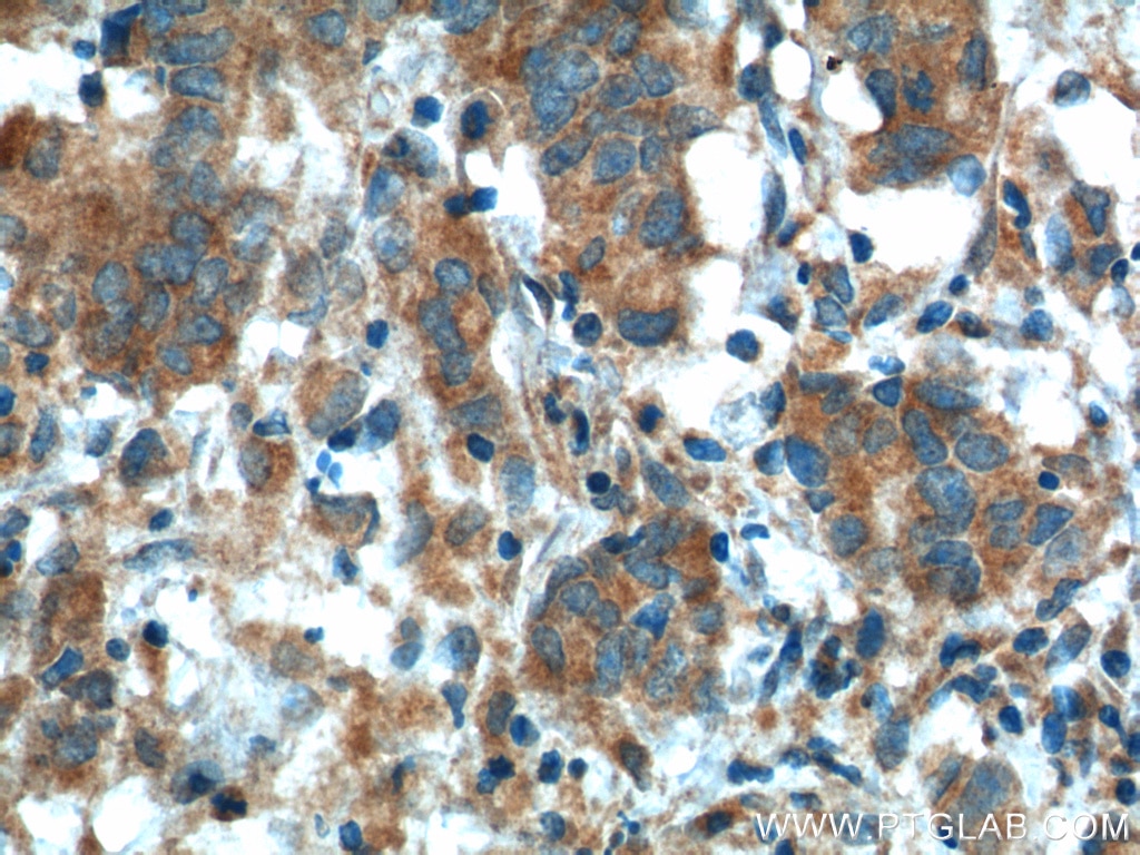KLK3/PSA antibody (10679-1-AP) | Proteintech
