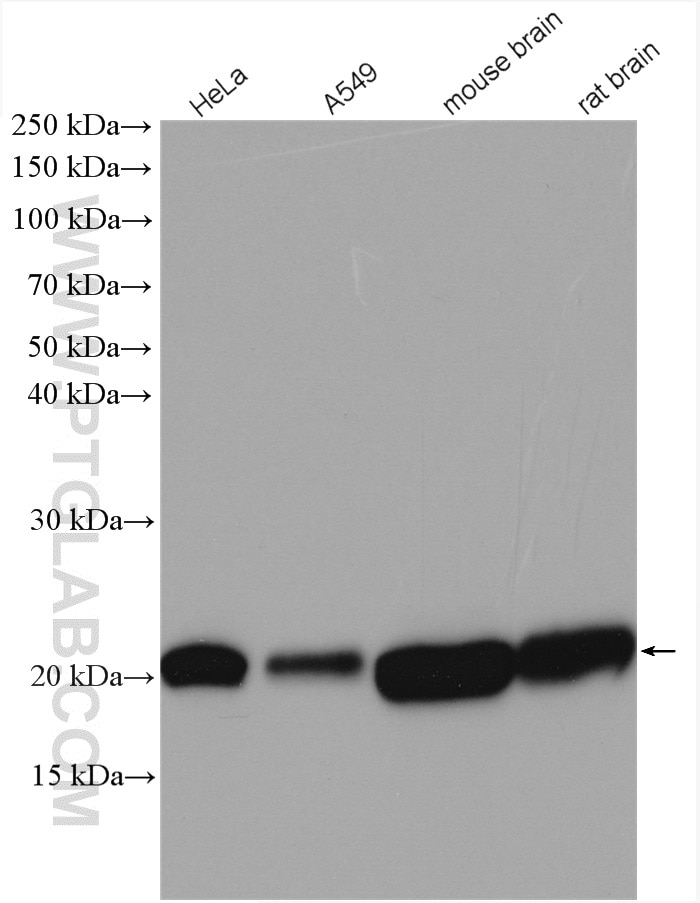 KRAS Antibody 12063-1-AP | Proteintech
