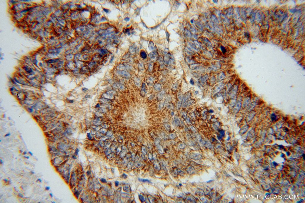 KRAS-2A-specific Antibody 16156-1-AP | Proteintech