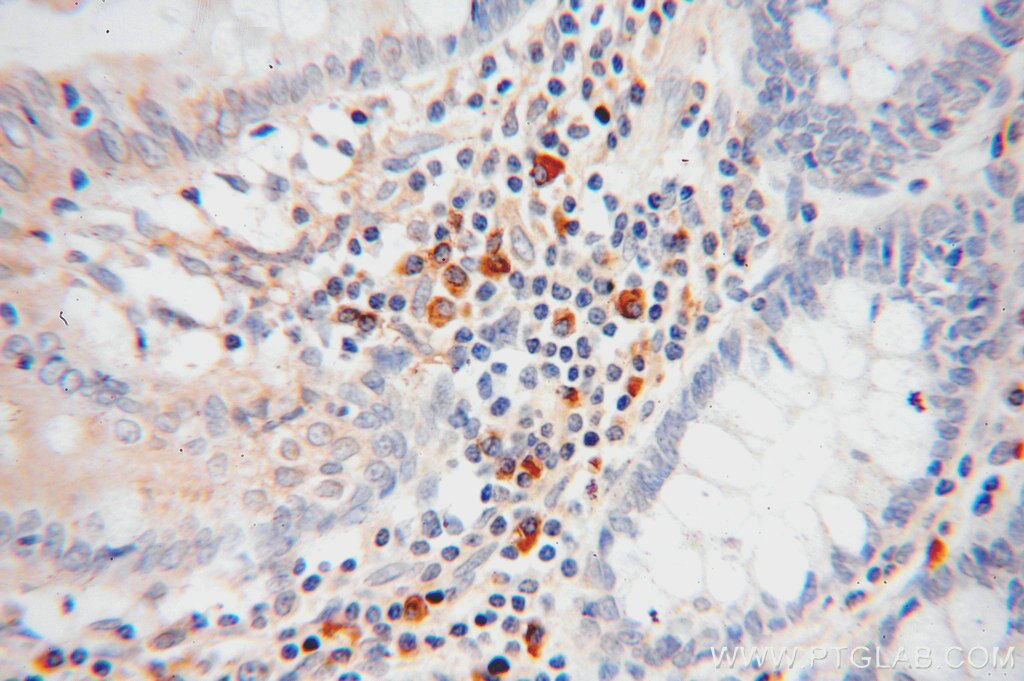 KRAS-2B-specific Antibody 16155-1-AP | Proteintech