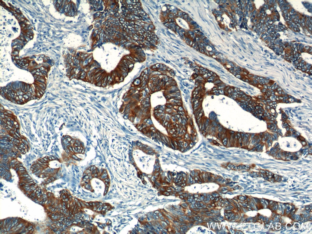 Cytokeratin 18 Antibody 10830-1-AP | Proteintech