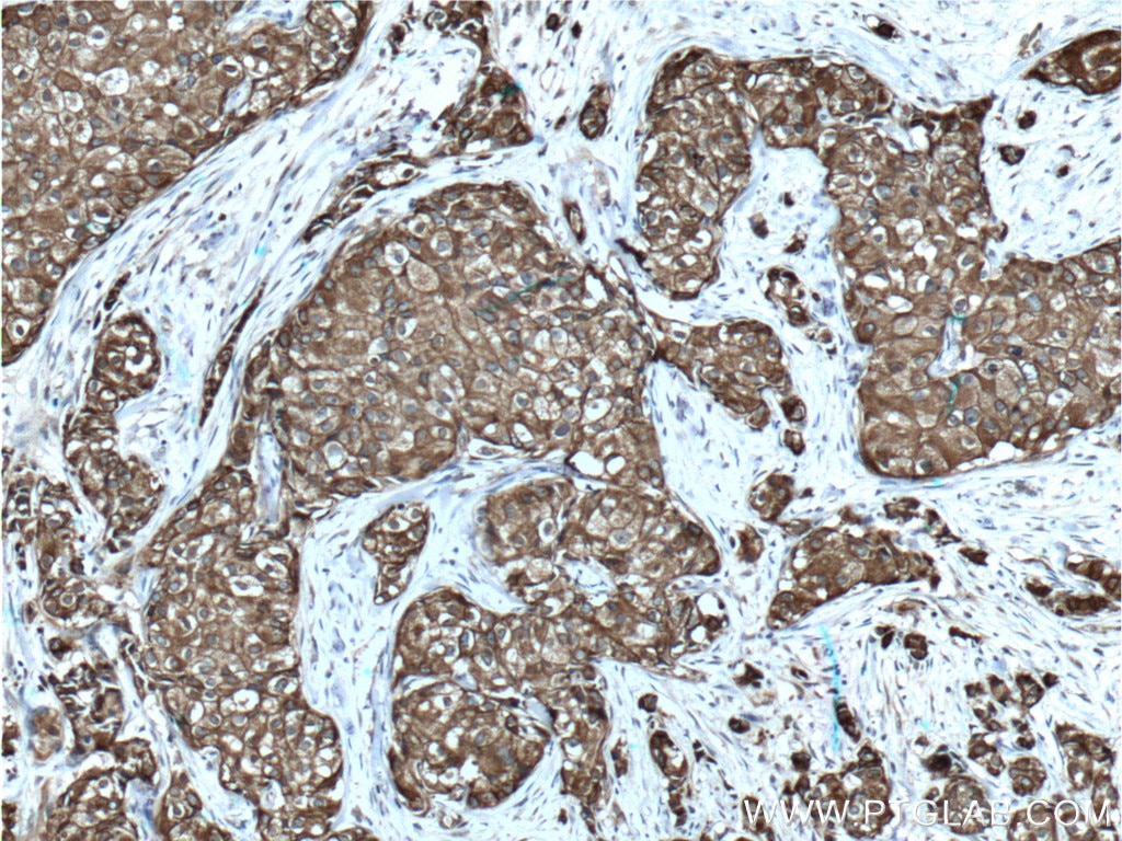 Cytokeratin 18 Antibody 10830-1-AP | Proteintech