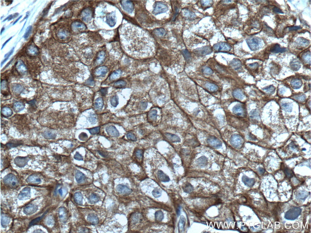 Cytokeratin 18 Antibody 10830-1-AP | Proteintech
