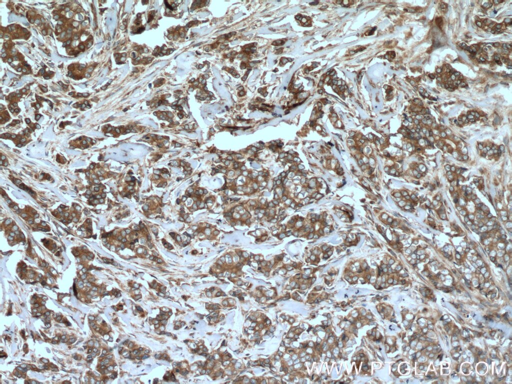 Cytokeratin 18 Antibody 18708-1-AP | Proteintech