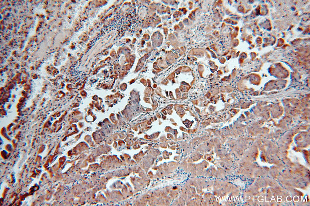 Cytokeratin 18 Antibody 18708-1-AP | Proteintech