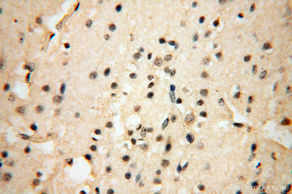 LAD1 Antibody 16136-1-AP | Proteintech