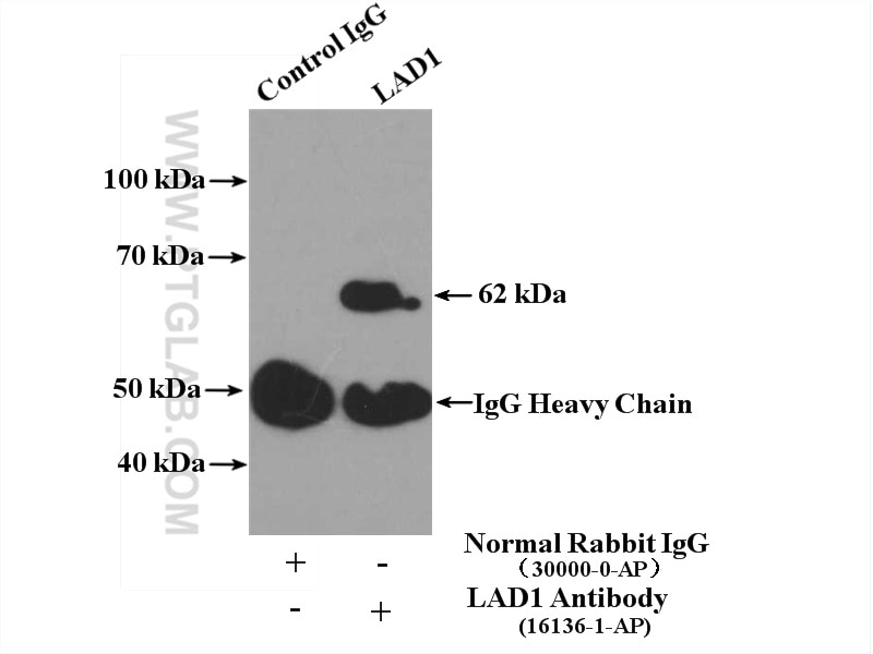 LAD1 Antibody 16136-1-AP | Proteintech