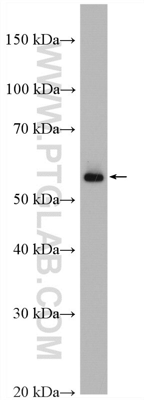 LAD1 Antibody 16136-1-AP | Proteintech