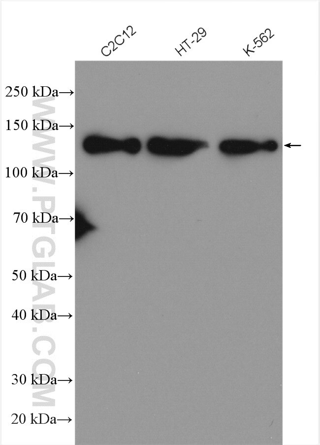 LATS1 Antibody 17049-1-AP | Proteintech