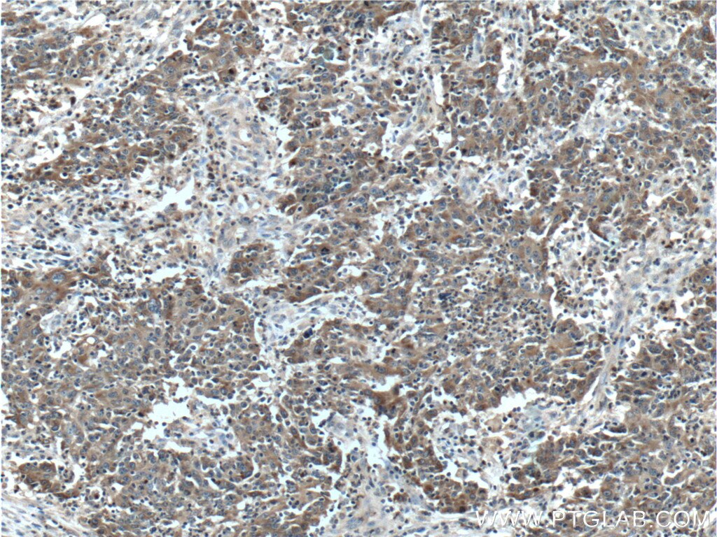 LCN2 Antibody 26991-1-AP | Proteintech
