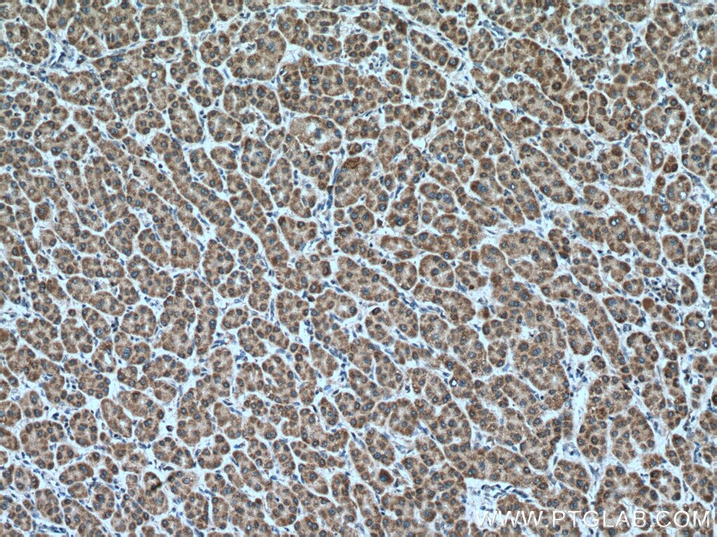 LDHD antibody (14398-1-AP) | Proteintech