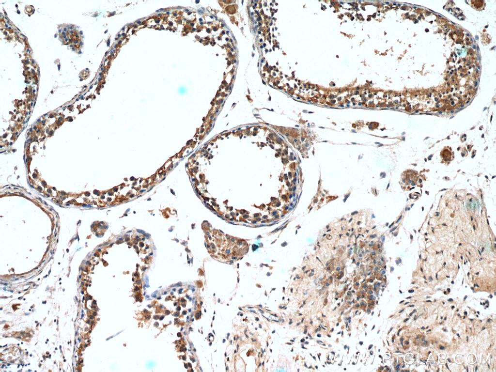 Leptin antibody (17436-1-AP) | Proteintech