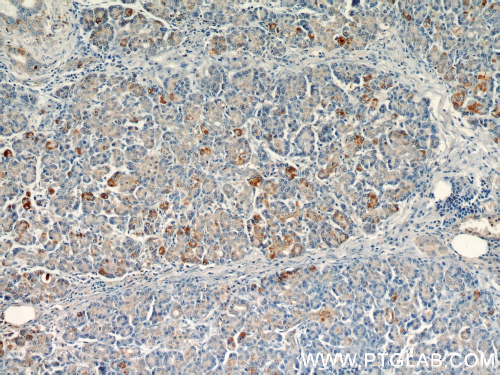 LRDD antibody (12119-1-AP) | Proteintech