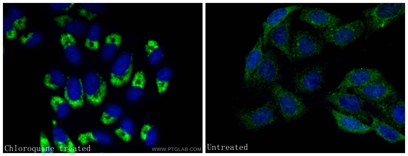 LC3 Antibody 14600-1-AP | Proteintech