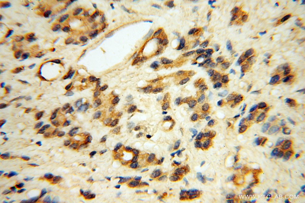 LC3 Antibody 14600-1-AP | Proteintech