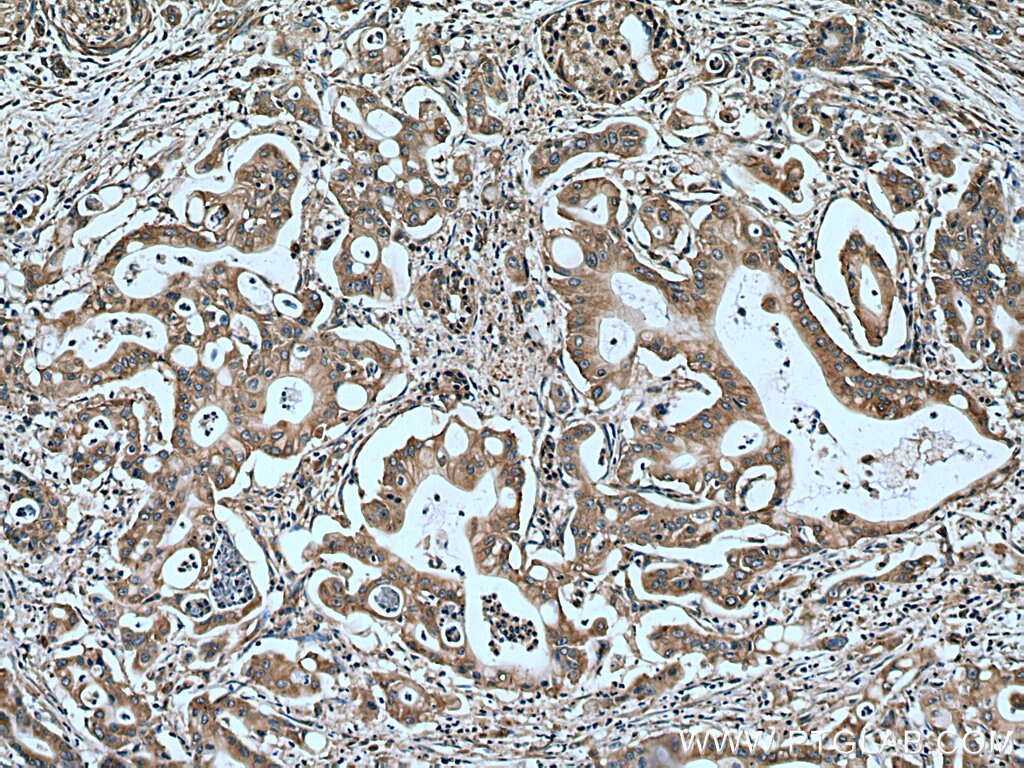 MAP1S antibody (15695-1-AP) | Proteintech