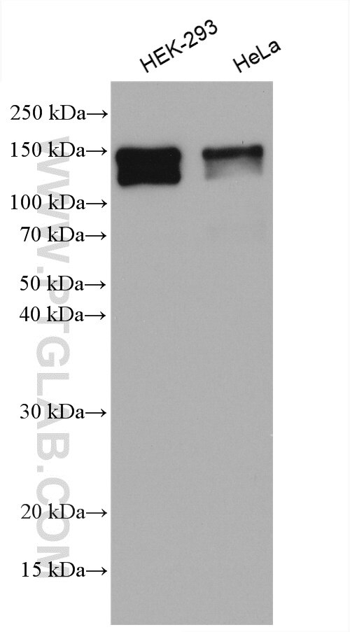 MAP1S antibody (15695-1-AP) | Proteintech