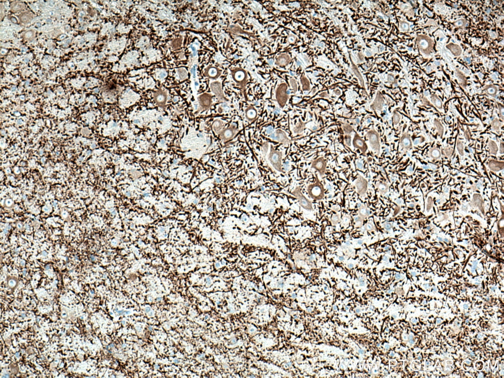 MAP2 antibody (67015-1-Ig) | Proteintech