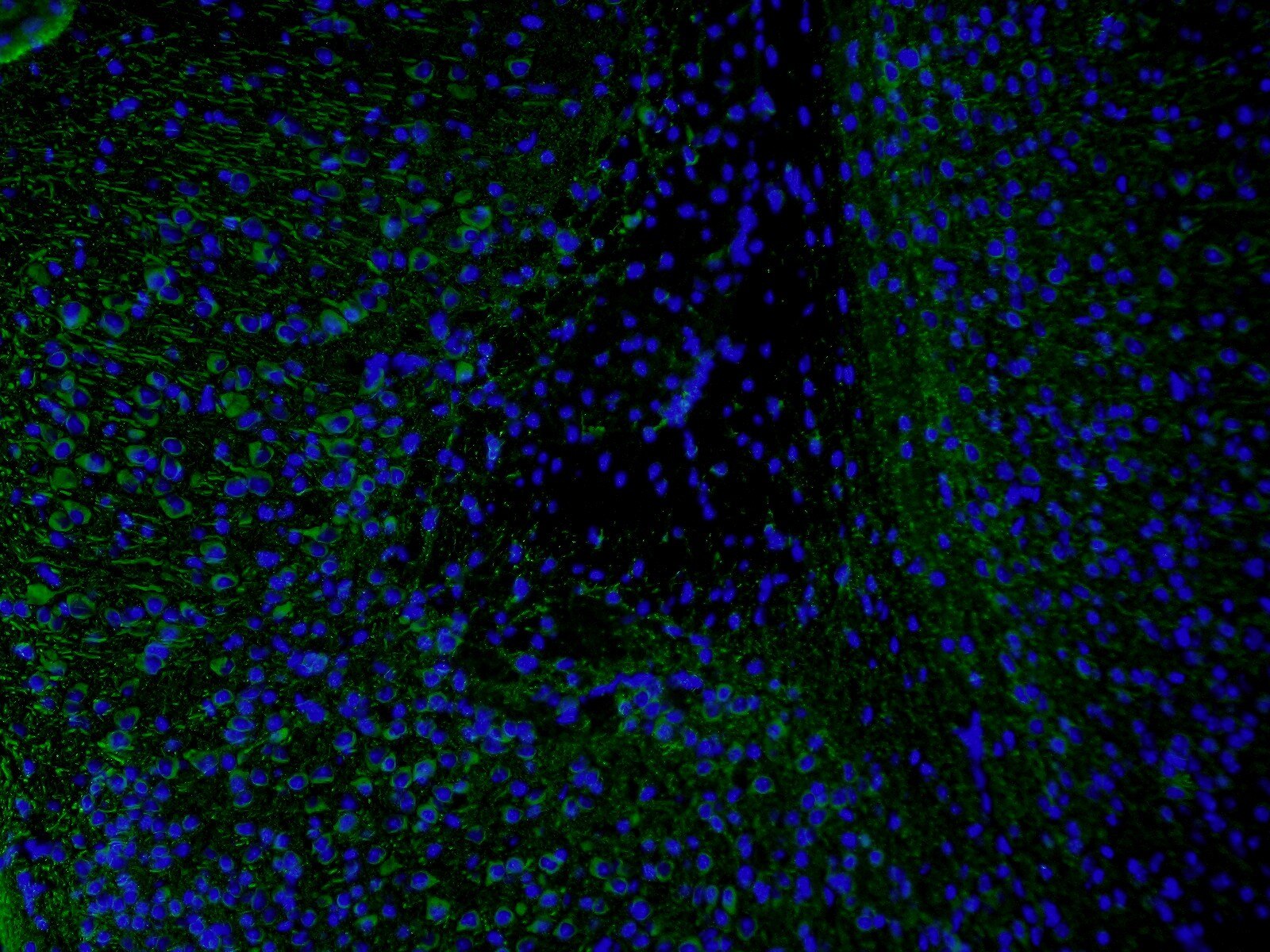 Map2 Antibody 17490 1 Ap Proteintech