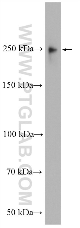 MAP4 antibody (11229-1-AP) | Proteintech