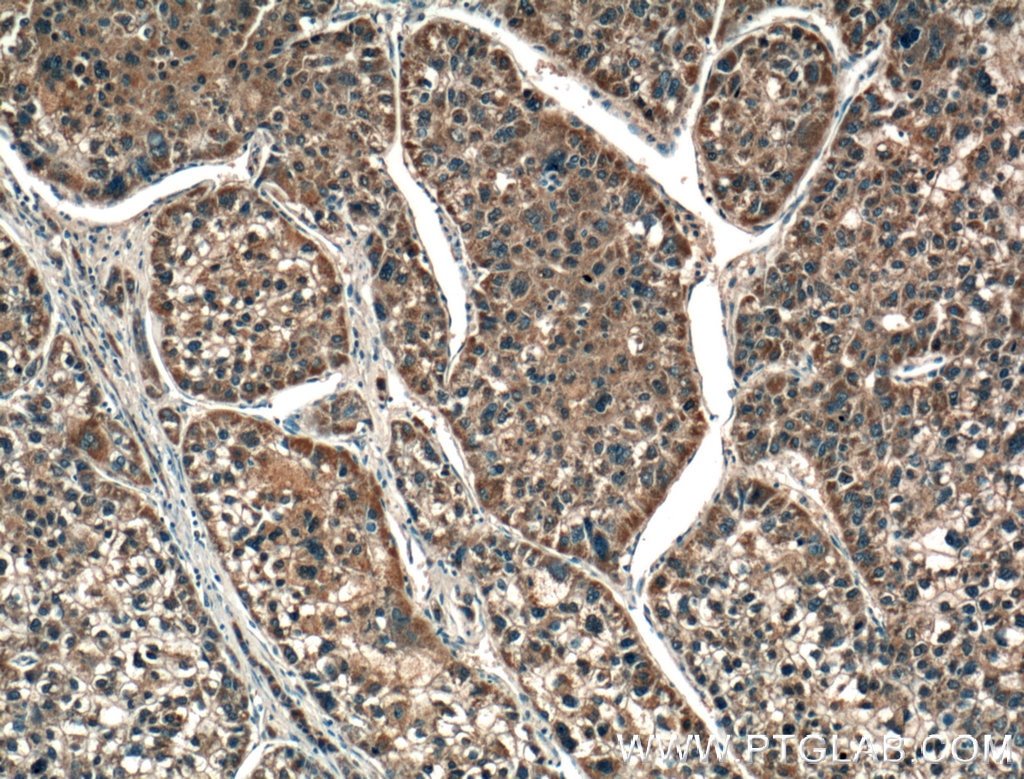 MASP1 antibody (21837-1-AP) | Proteintech