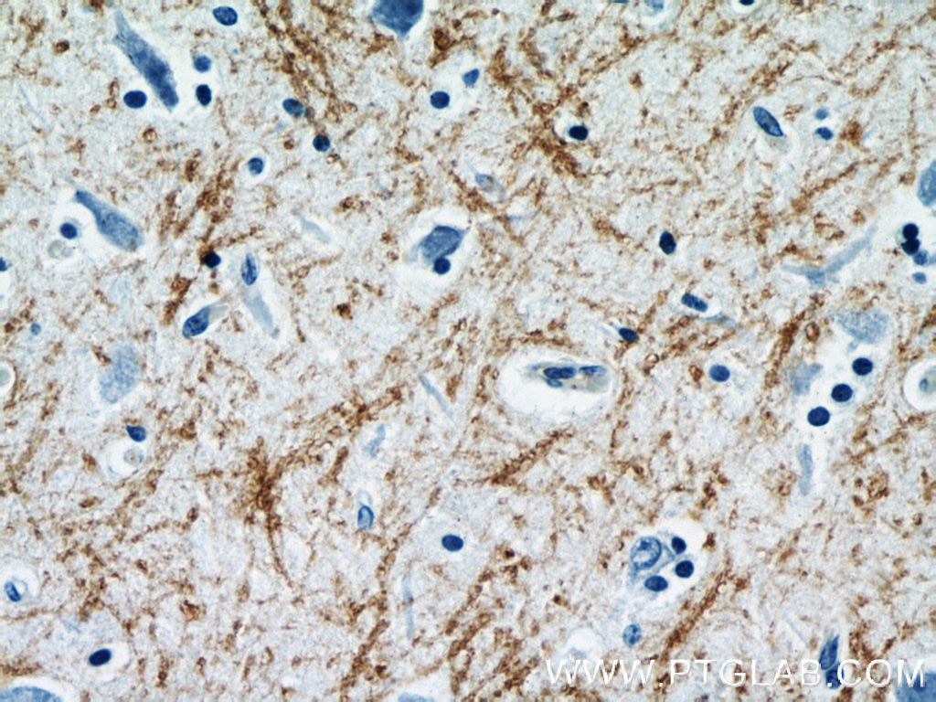Myelin basic protein Antibody 10458-1-AP | Proteintech