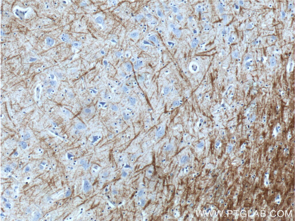 Myelin basic protein Antibody 10458-1-AP | Proteintech