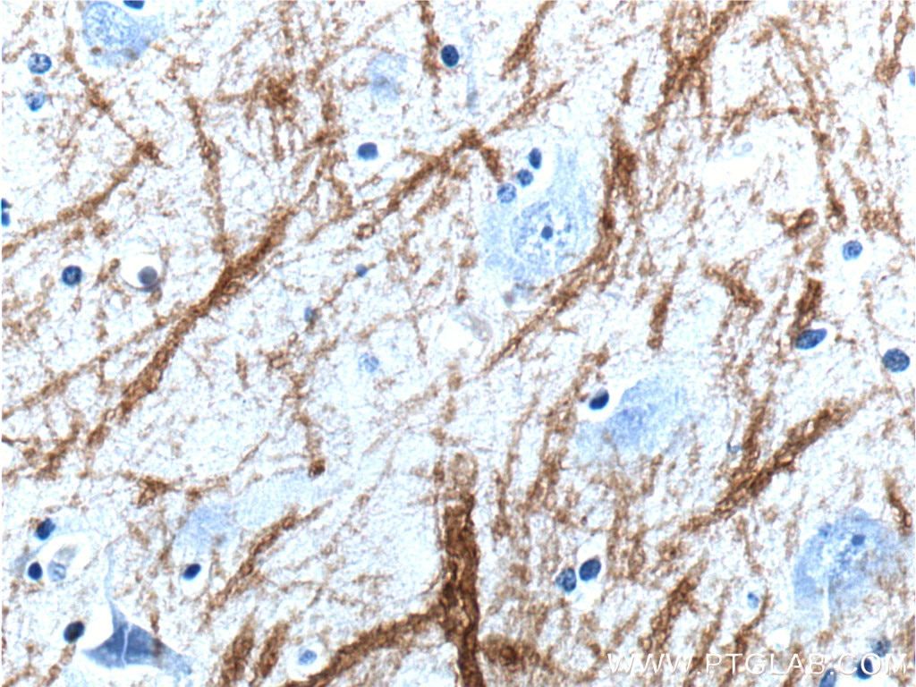 Myelin basic protein Antibody 10458-1-AP | Proteintech