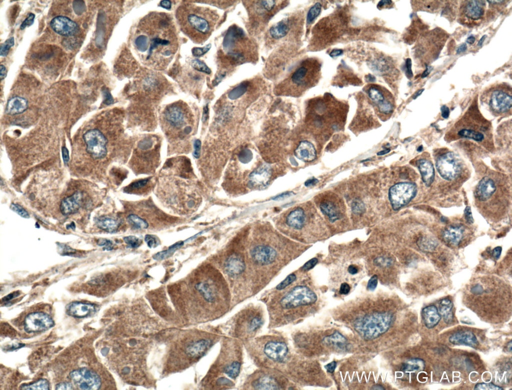 MCP1 antibody (25542-1-AP) | Proteintech