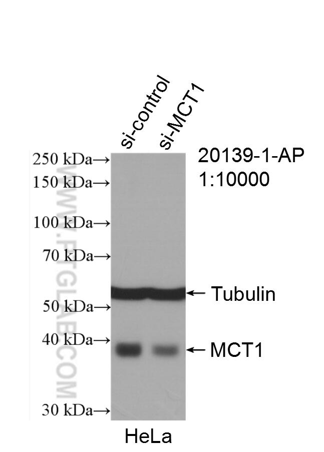 MCT1 Antibody 20139-1-AP | Proteintech