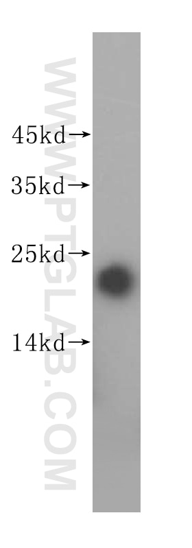 MGMT Antibody 17195-1-AP | Proteintech