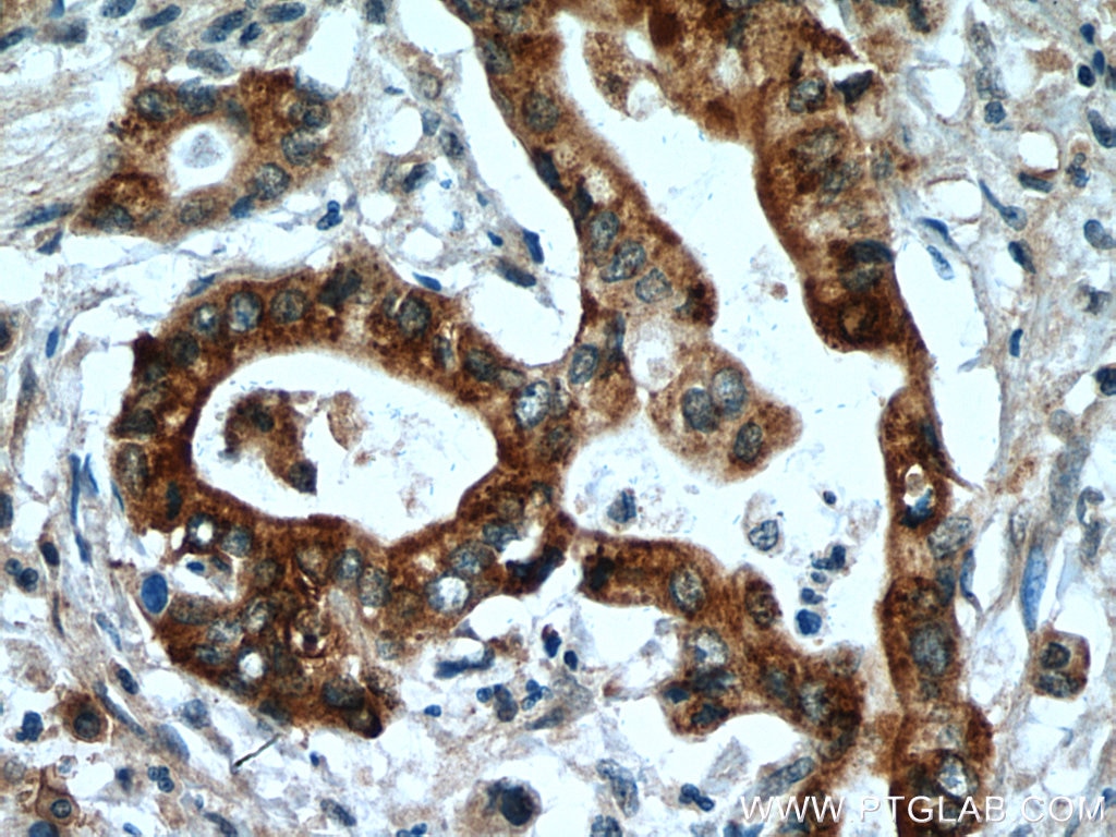 MMP1 antibody (10371-2-AP) | Proteintech