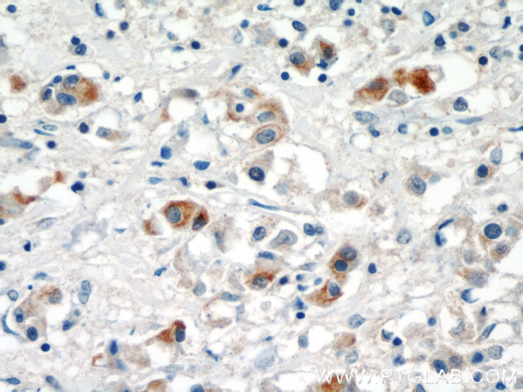 MMP3 antibody (17873-1-AP) | Proteintech